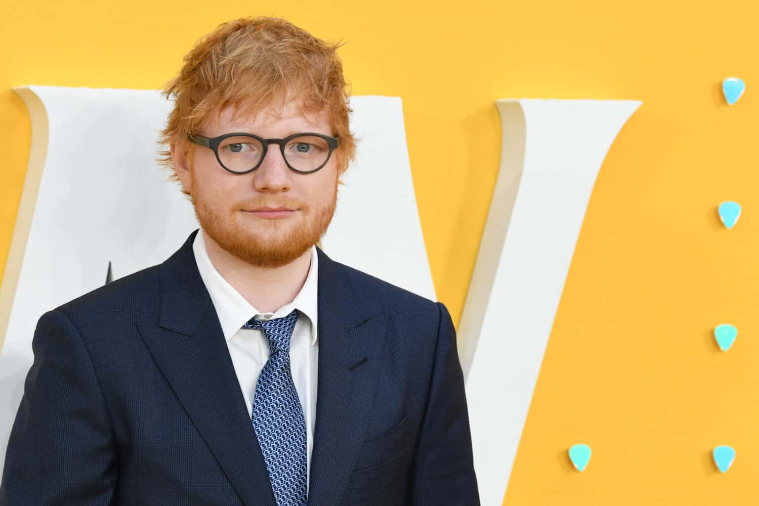 Is Ed Sheeran Cross Eyed?