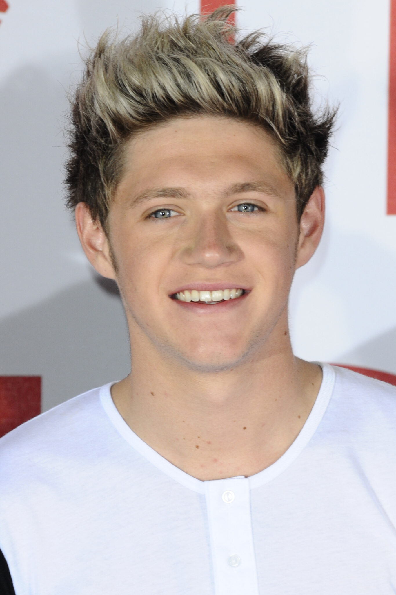 Did Niall Horan Have Braces?